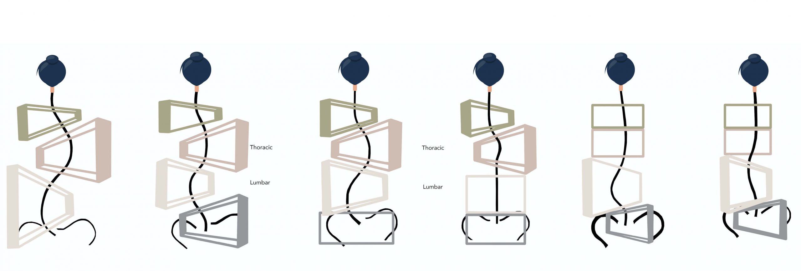 The Schroth Method - Physiolutions
